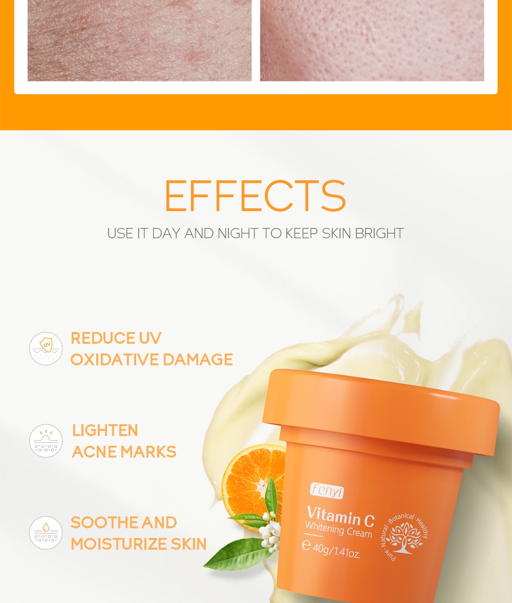 FENYI Vitamin C Whitening Cream VC Face Moisturizer Refreshing Brightening Reduce Spots Skin ...