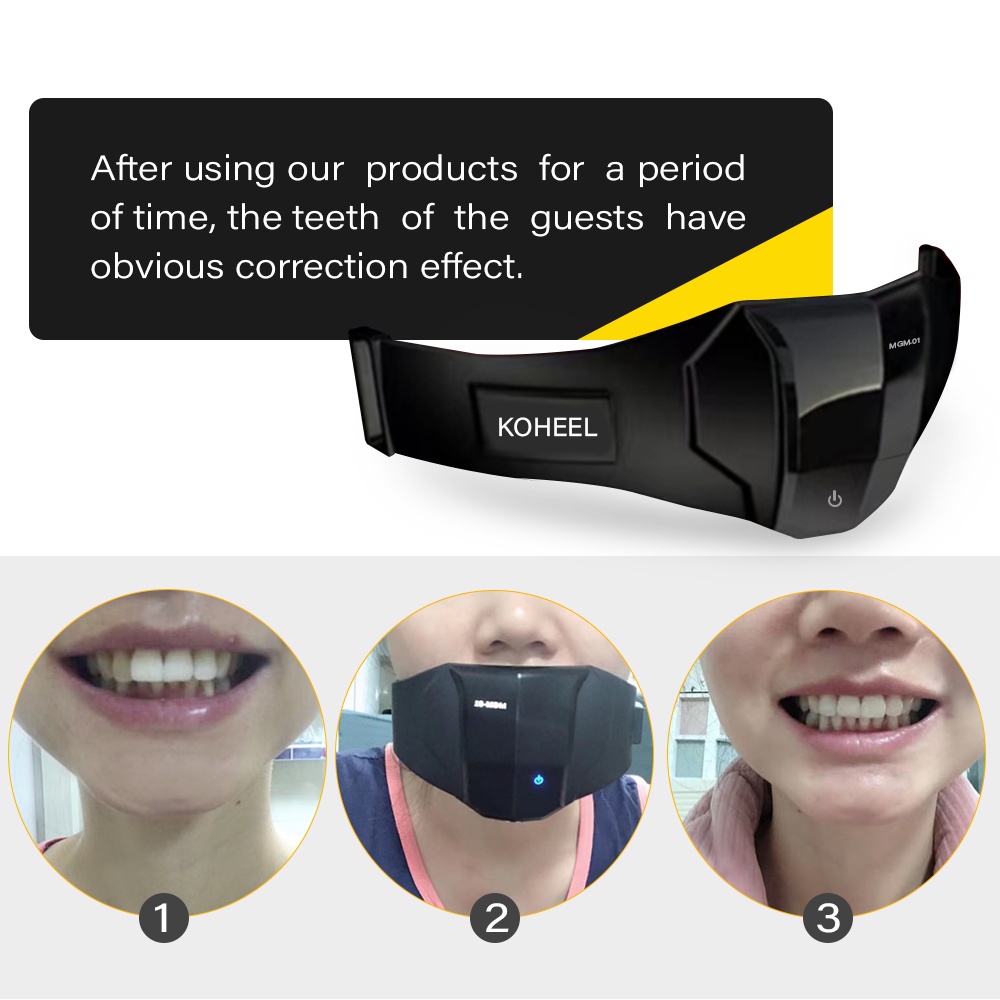 KOHEEL MGM Braces Teeth, Teeth Straightener with Harmonic Vibration for Open Bite,Overbite,Gap ...