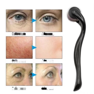 540 Dermal Roller 0.25mm/0.5mm/1mm/1.5mm/2mm Microneedle Skin ...