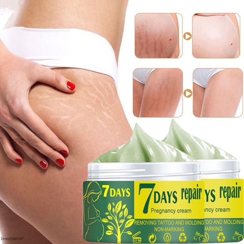 Stretch Mark Removal Removal Acne Scar Stretch Marks Cream Fat Striae