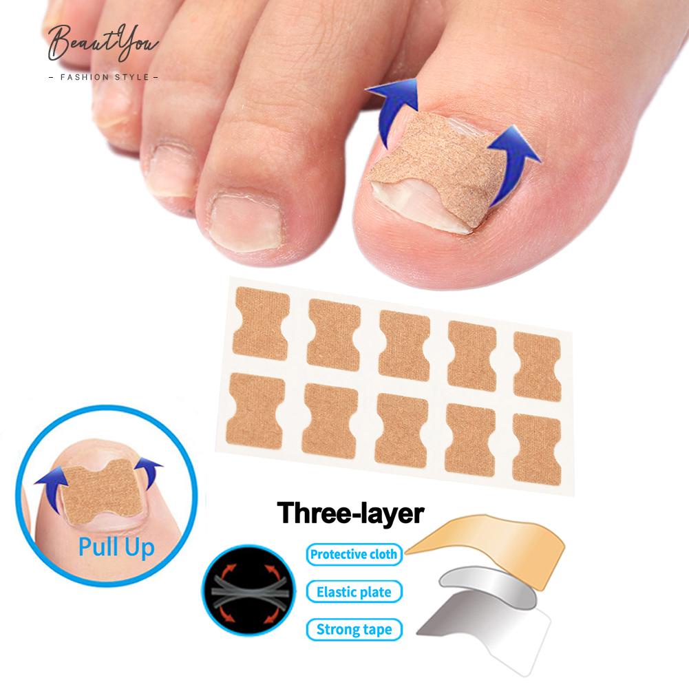 Beauty-Paronychia Inlay Patch Painless Ingrown Toenail Correction ...