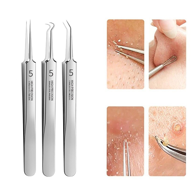 Salorie Face Cleanser Extract Tools Needle Tweezer Acne Blackhead ...