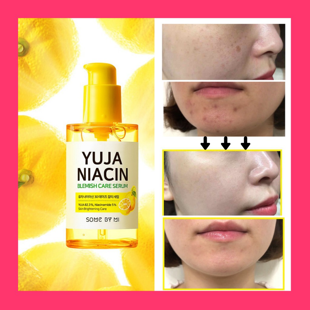 some by mi yuja niacin 30 days blemish care SERUM 50ml / Somebymi Yuja ...