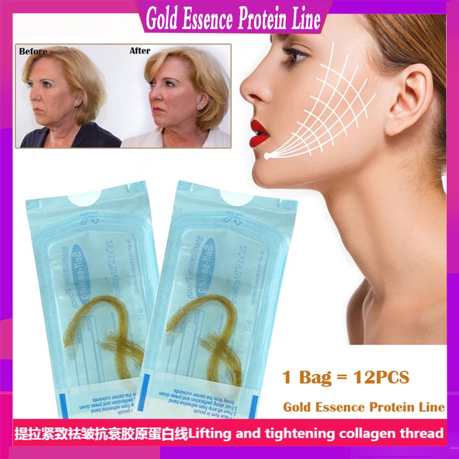 Face Filler Soluble Face Lifting Threads Absorbable Collagen Protein ...
