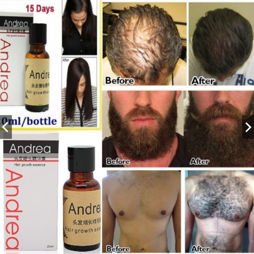 RM6 Andrea Hair Growth Essence Dense Anti Hair Loss Liquid Essence Oil ...