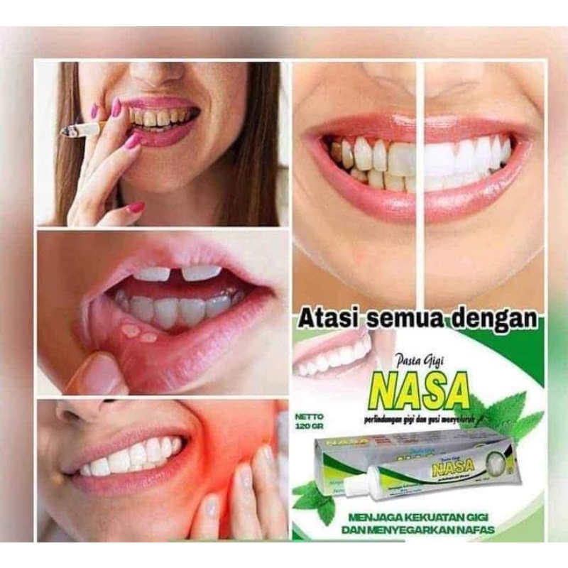 Nasa Toothpaste/NASA Toothpaste 120gr-PGN NASA (Tooth flak Loss/Tooth ...