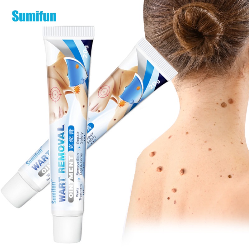 20g Skin Tags Warts Remover Cream Face Body Tag Remover Herbal Ointment ...