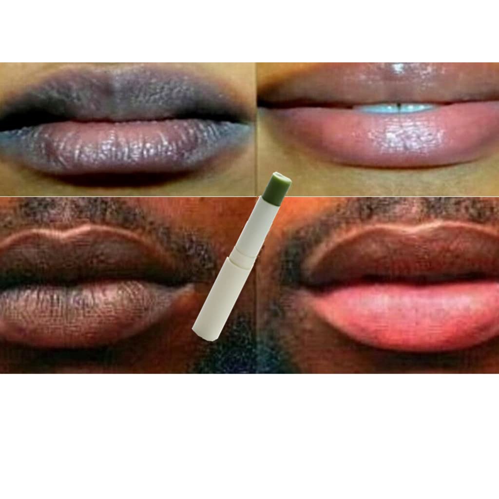 New Pink Fresh Lightening Cream Blackish Green Balm Treatment Remove ...