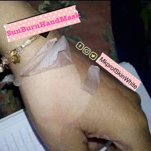 Sunburn HAND MASK (Exfoliating SKIN) | Shopee Singapore