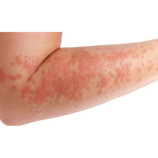 Lymarin Cream (Eczema) 15g Thailand thailand Lymarin Cream 15g用于皮肤敏感/炎症 ...