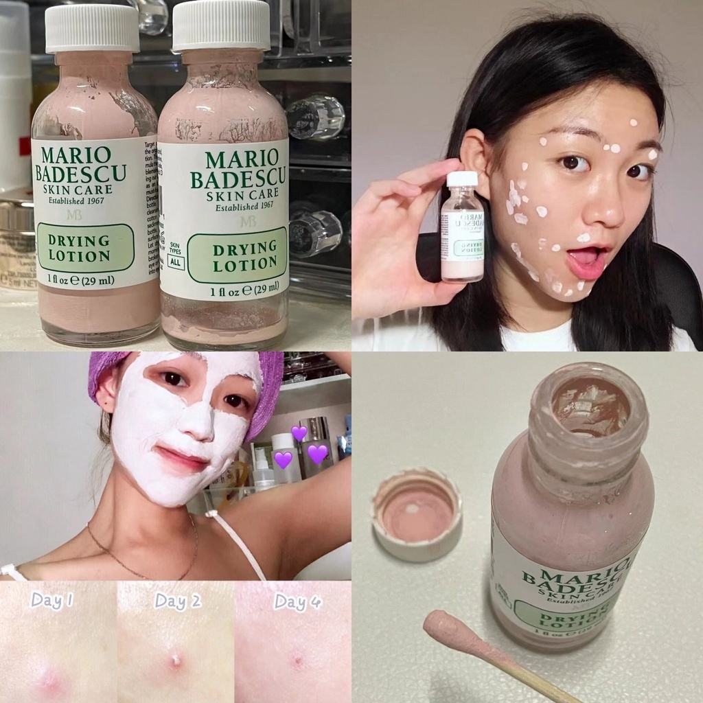 Mario Badescu DRYING LOTION FOR ALL SKIN TYPES 29ML Acne Cleansing ...