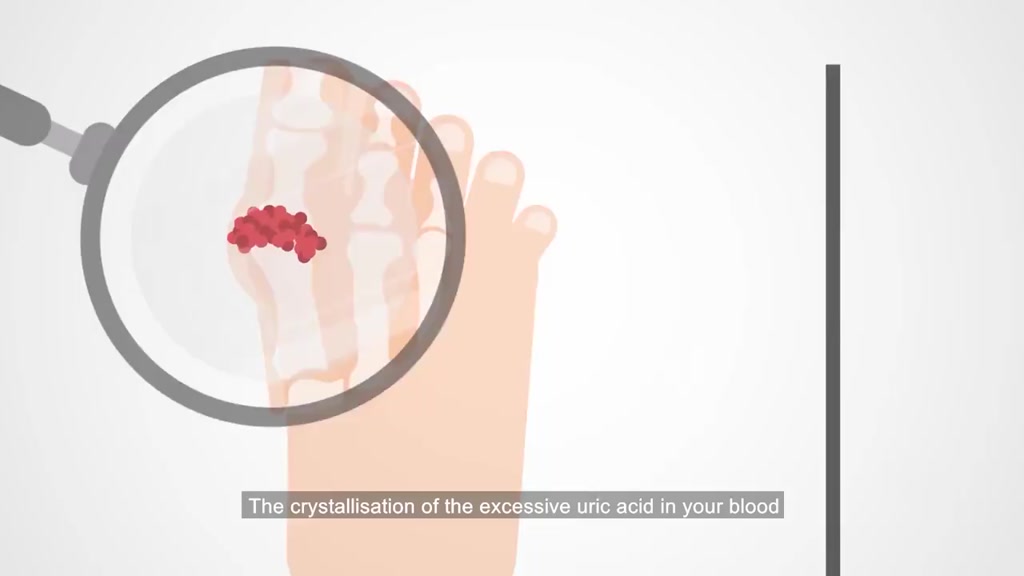 Ural Effervescent Granules 28 Sachets (Lemon) | UTI Relief, Gout ...