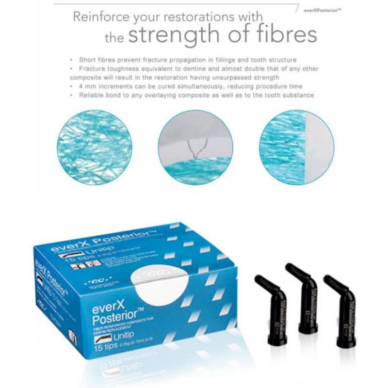 Gc everX ever x retail fiber posterior composite restoration tip fiber ...