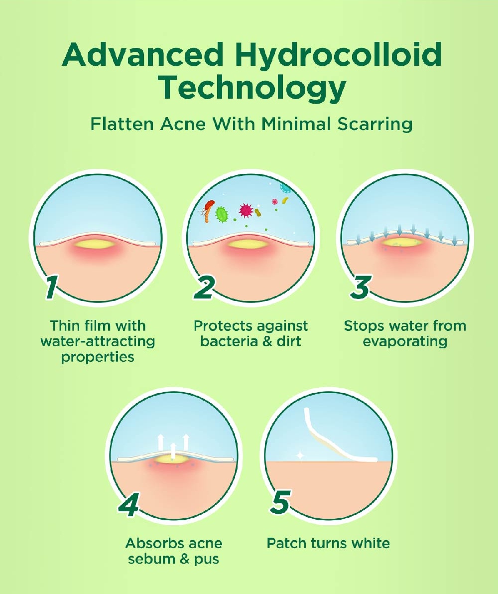 ACNES Anti-Bacterial Acne Patch for Night 0.03cm 26s | Shopee Singapore