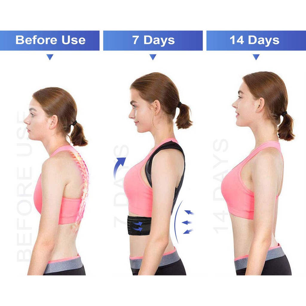 Posture Corrector Japanese Style for Male and Female Humpback ...