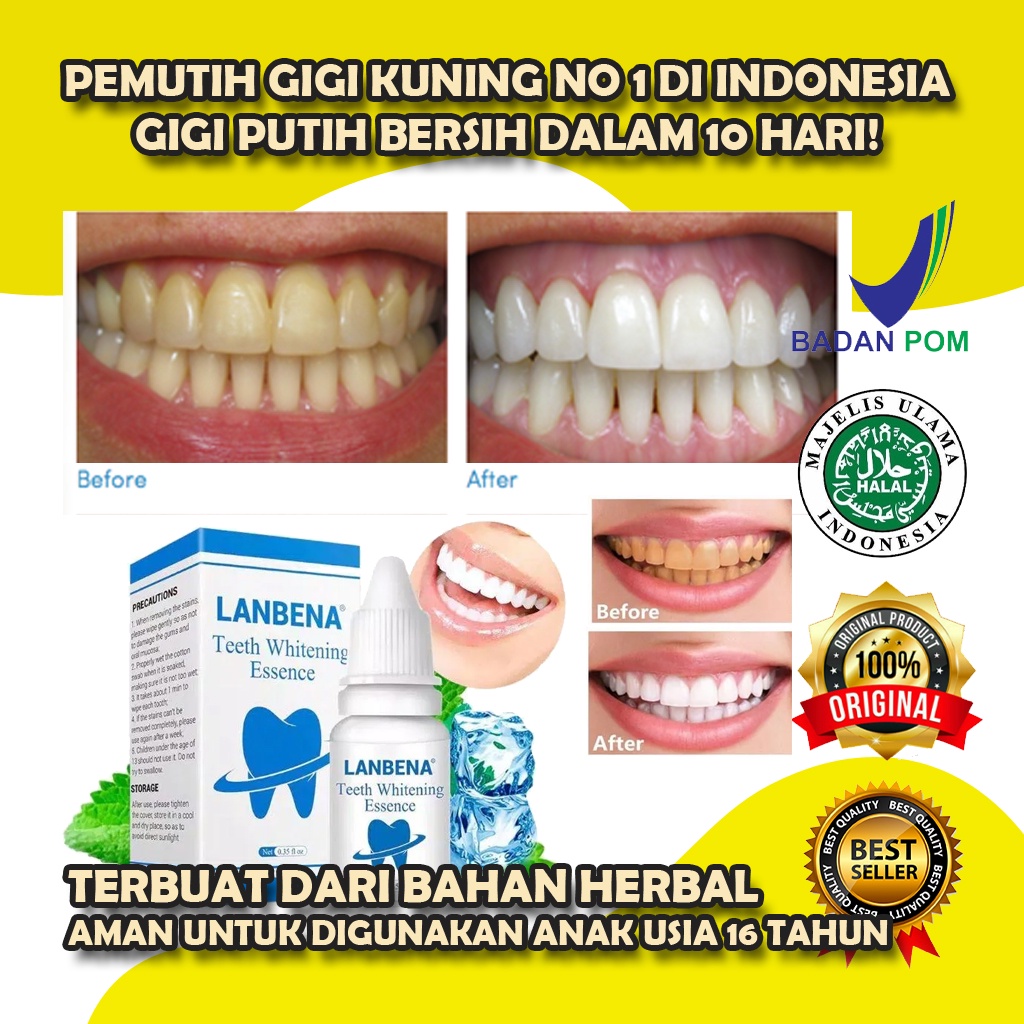 Lanbenna Bleaching TEETH WHITENING Dental Bleaching Dental Bleaching ...