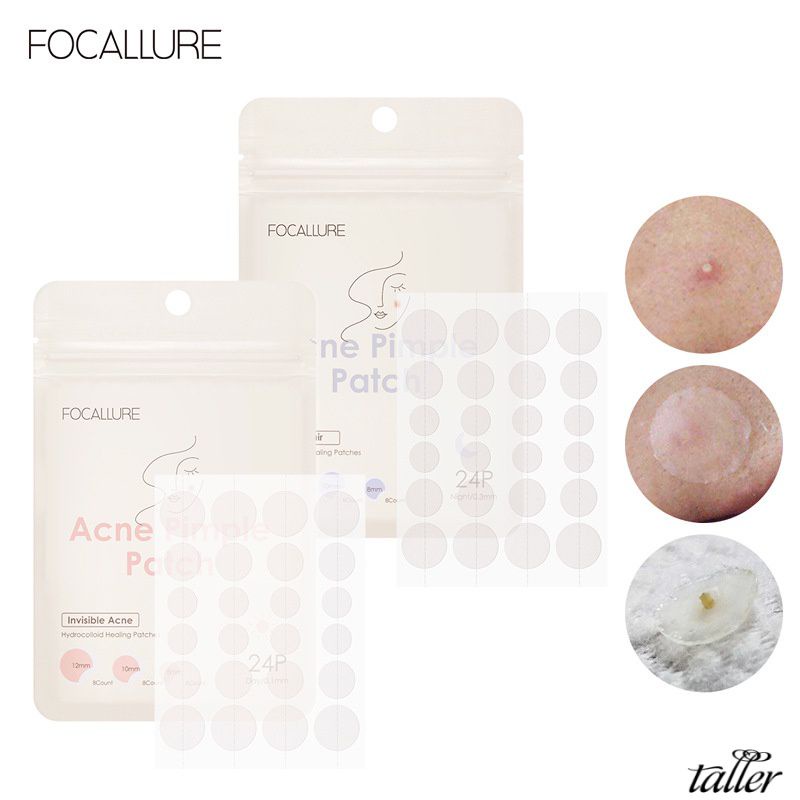 FOCALLURE Waterproof Acne Patch Remover Blemish Treatment Skin Care ...