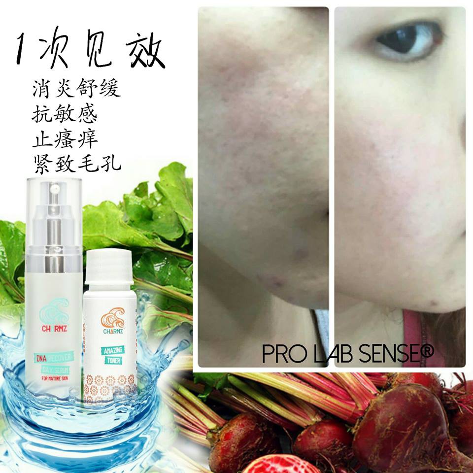 Charmz Okinawa DNA Recover Serum SPF 30+ Pro Lab Sense 抗老胜汰修复细胞精华液 (30ml) | Shopee Singapore