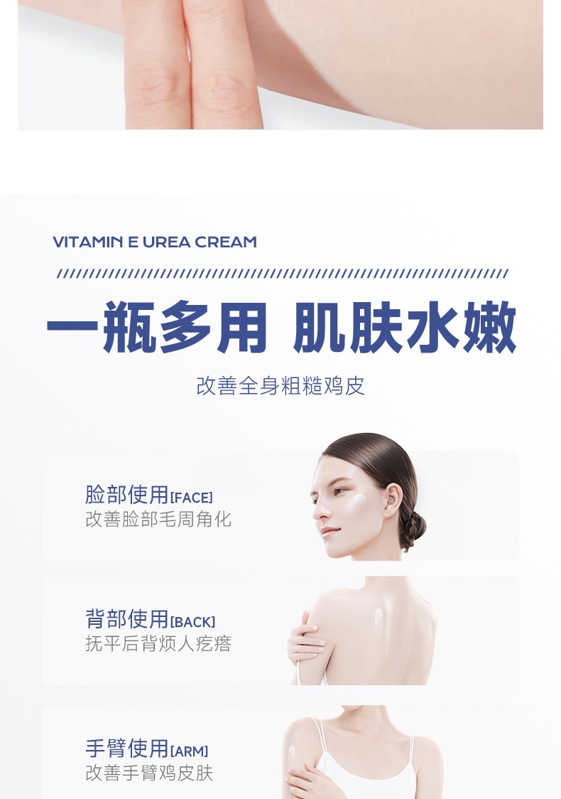 Nicor Vitamin E Urea Cream Moisturizing Antifreeze Anti-Drying ...