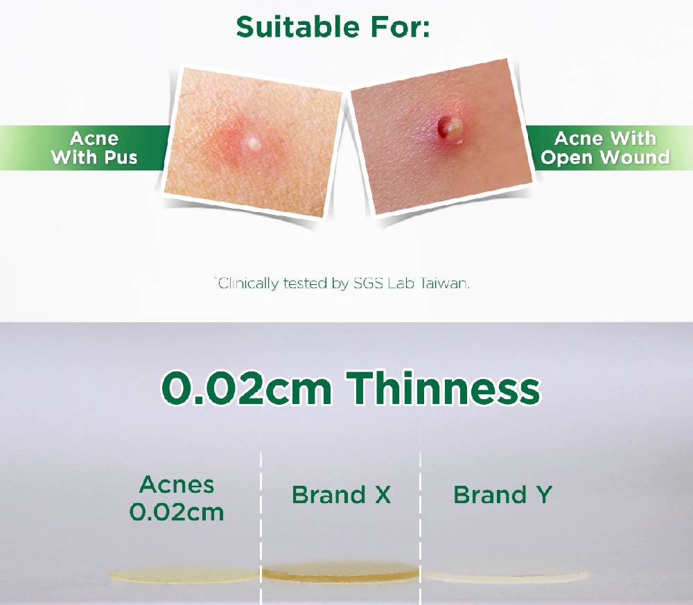 ACNES Anti-Bacterial Acne Patch for Night 0.03cm 26s | Shopee Singapore