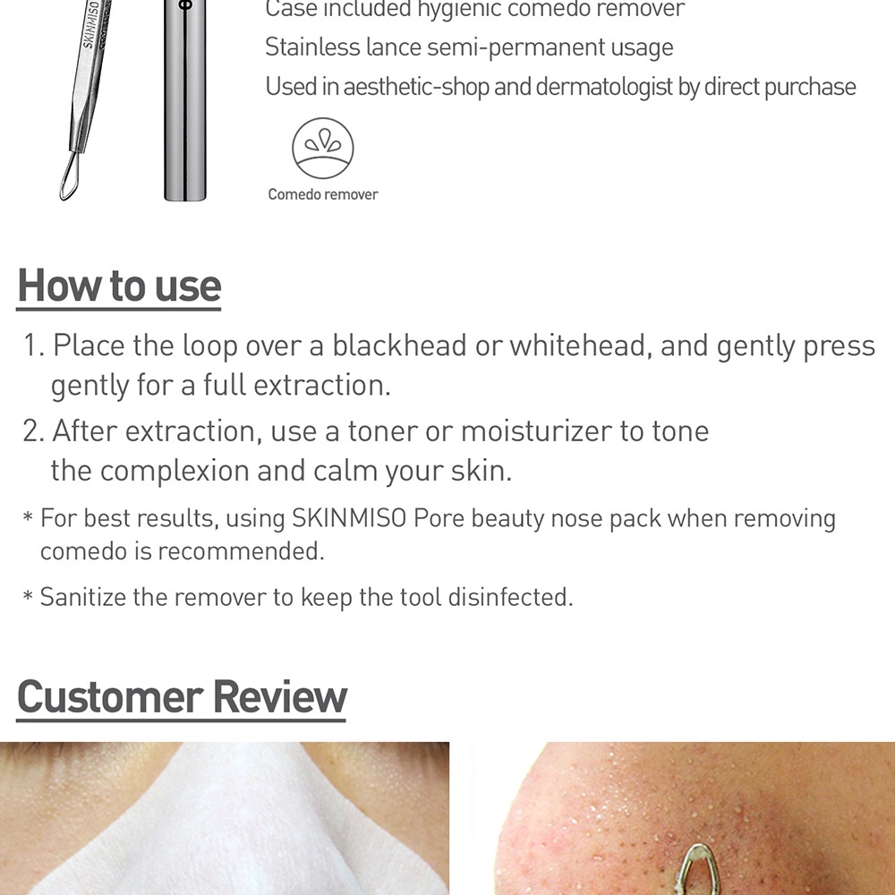 Skinmiso Comedo Remover – Blackhead & Whitehead Extractor Tool | Shopee ...