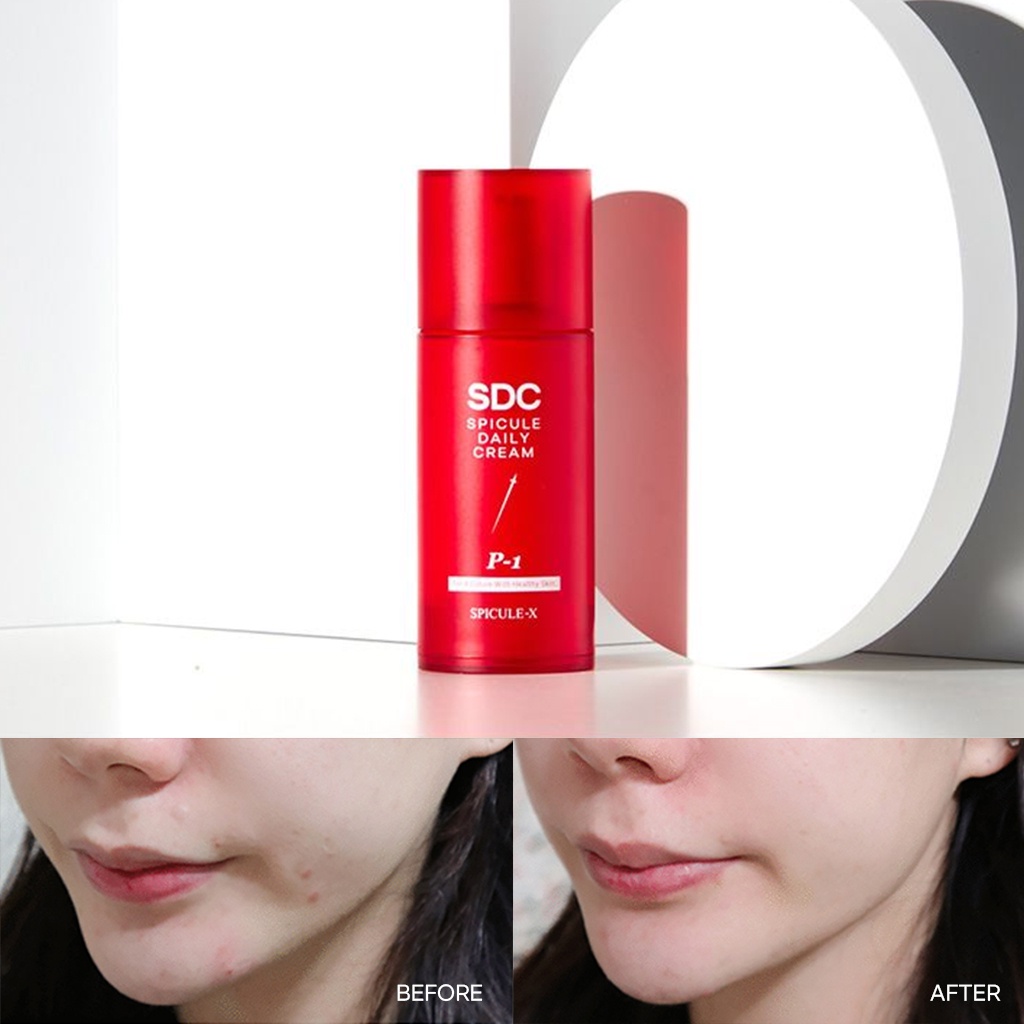 [Spicule-X] Spicule Cream Daily Cream/ Moisturizing Skin Cream ...