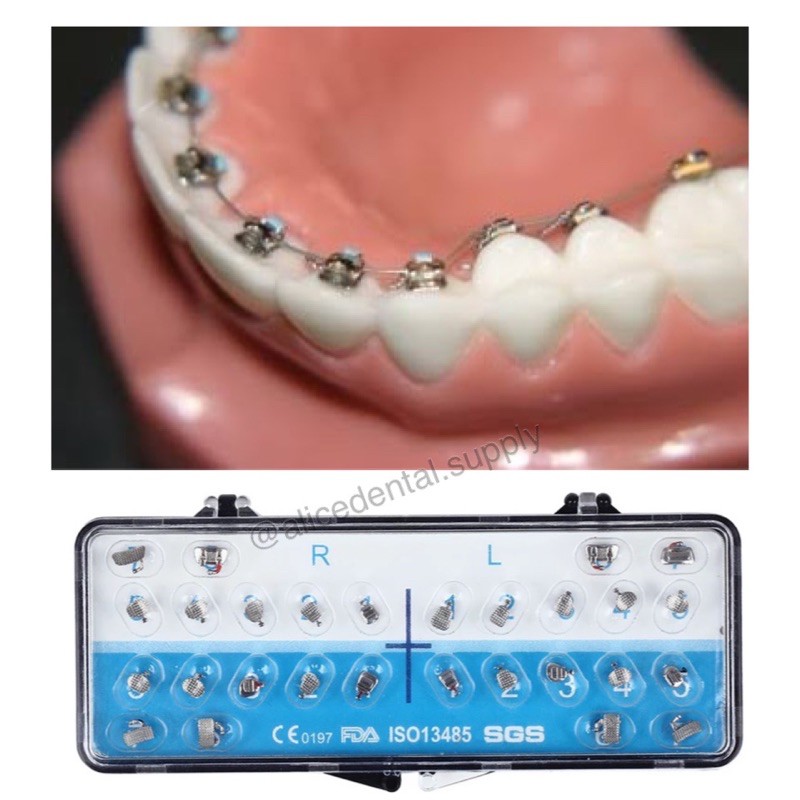 Dental Lingual braces metal brace palatal bracket In Teeth free buccal ...