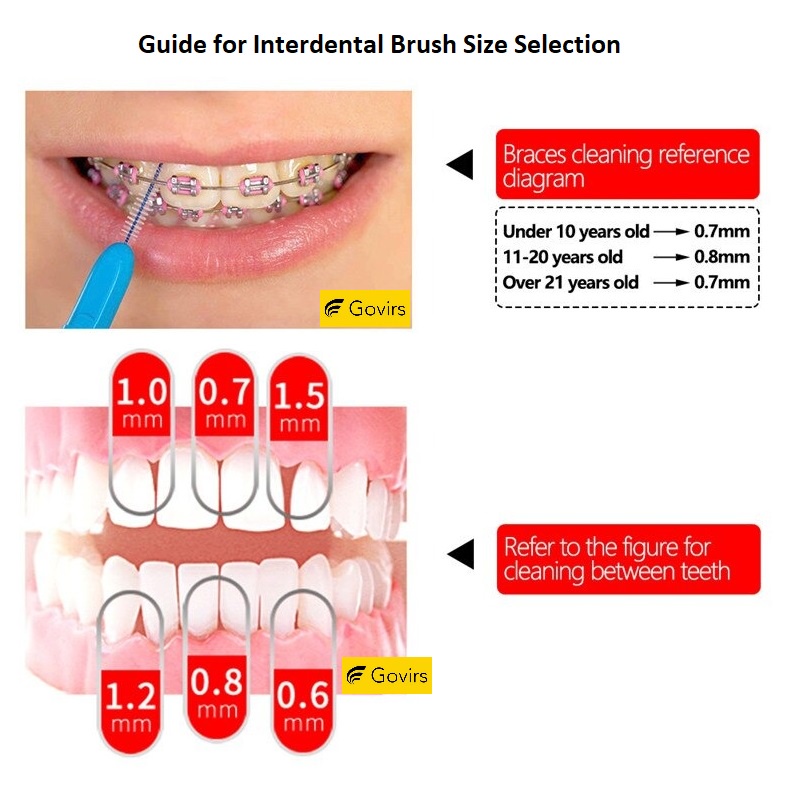 GPC Interdental Brush L Shape for Teeth and Braces 20pcs Pack | Shopee ...