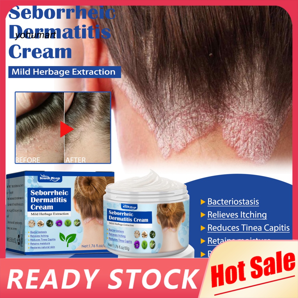 No Adverse Reaction Psoriasis Balm Head Seborrheic Dermatitis Cream ...