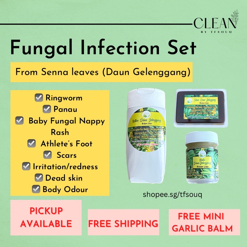 💯ORIGINAL Senna Leaves Daun Gelenggang Balm Nappy Fungal Rash, Athlete ...