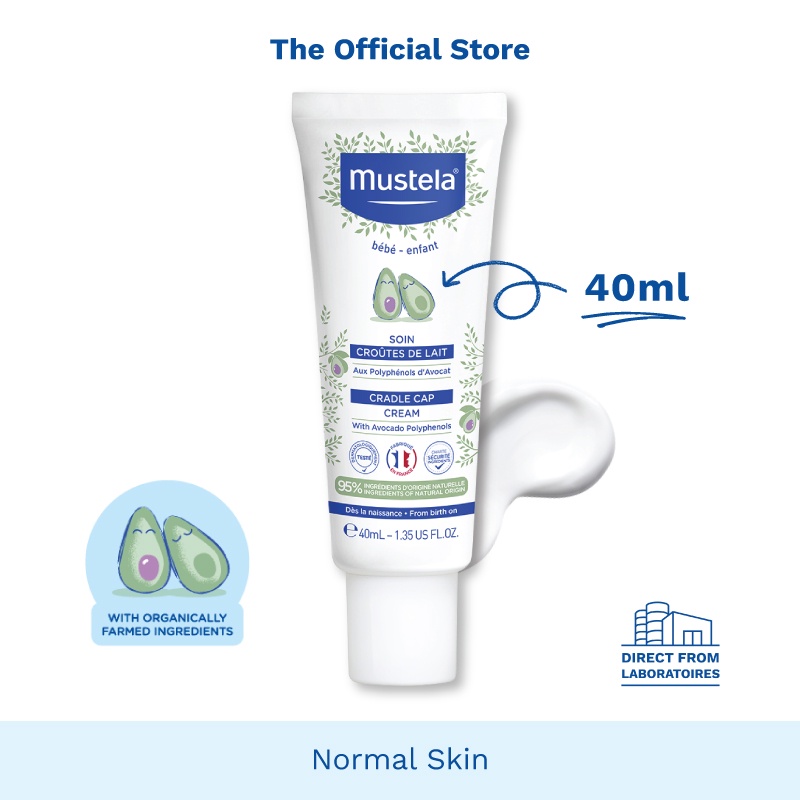 Mustela Cradle Cap Cream 40ml (exp 11/2026) | Shopee Singapore