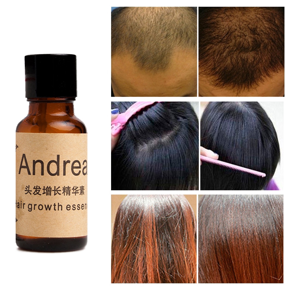 【Ready stock】Original Andrea Hair Growth Essence Dense Anti Hair Loss ...