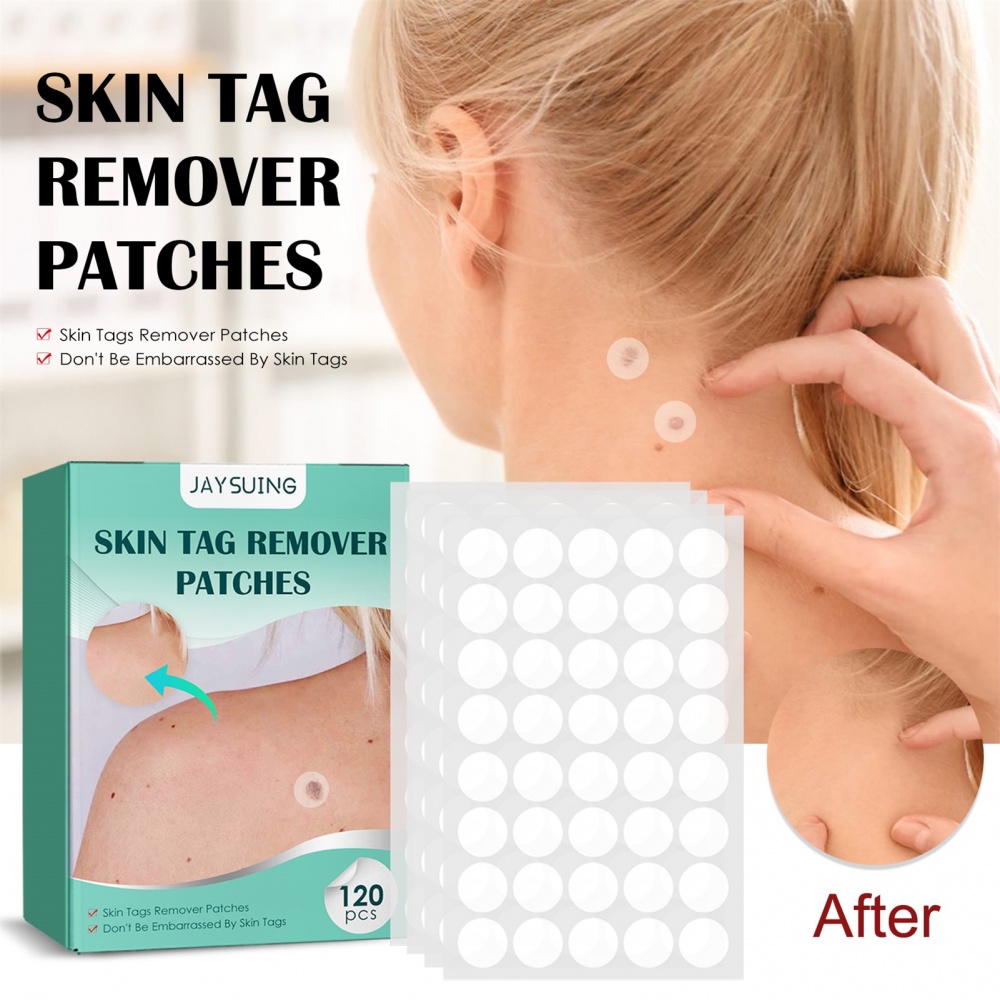 120PCS/Box Warts Remover Patch Safe Painless Skin Tags Patches Pimple ...