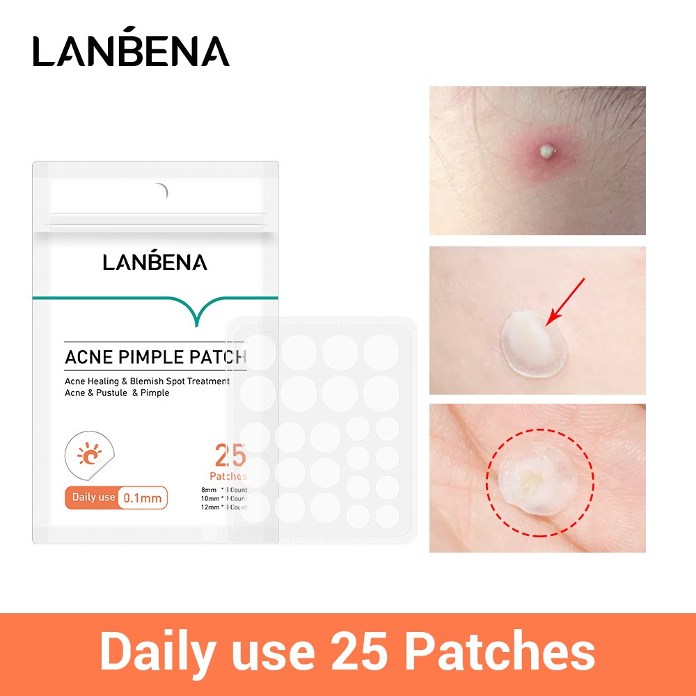 LANBENA Acne Pimple Patch Invisible Acne Stickers Pimple Remover Tool ...