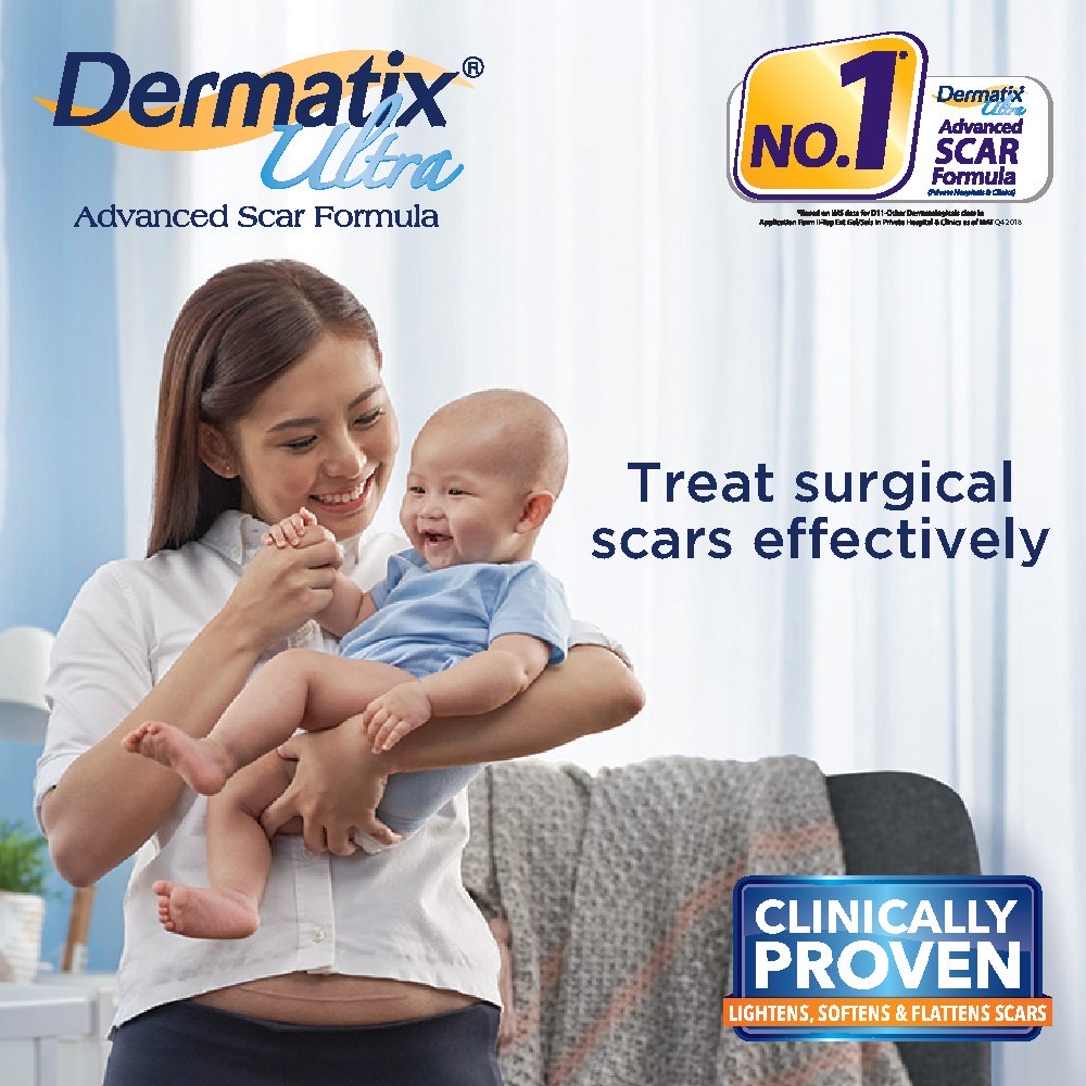 Dermatix Ultra 15g (Advanced Scar Formula) | Shopee Singapore