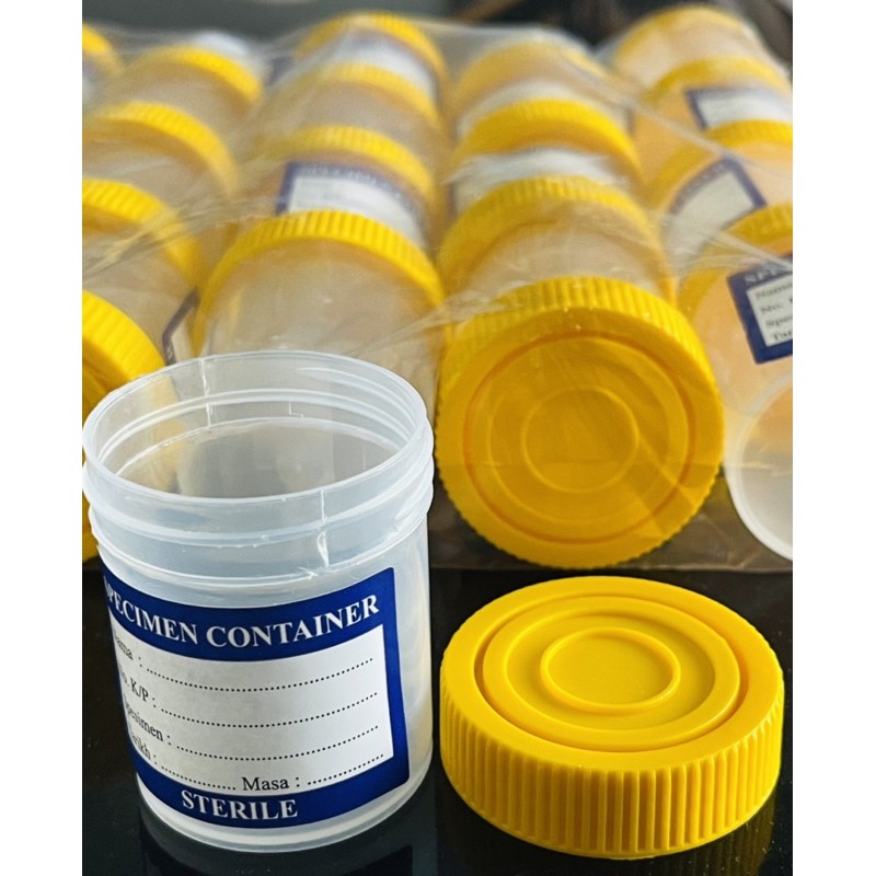 Urine Specimen Container | With Yellow Screw Cap | With Label | 60ml ...