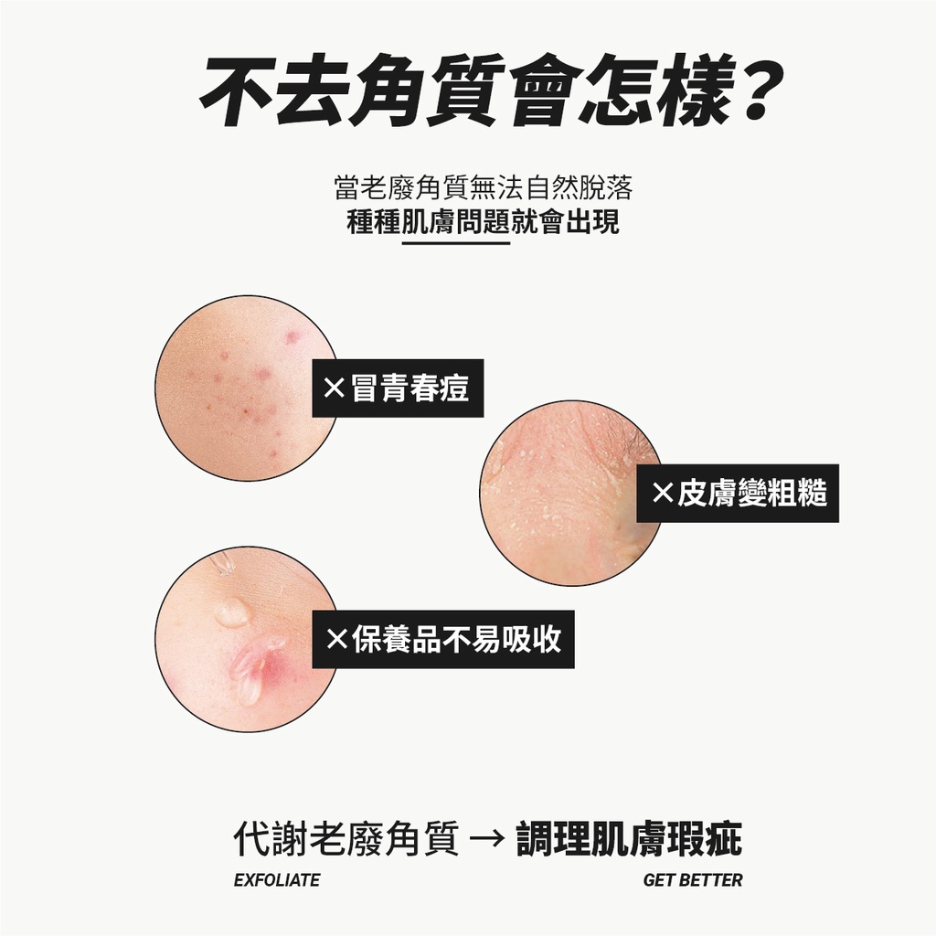 Tt Ultra Purifying Exfoliating Cleansing Group|Anti-Acne Oil Control Metabolic Keratin [TRUE ...