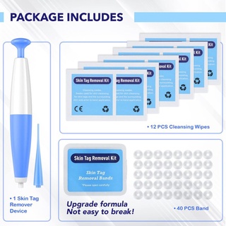 Skin Tag Remover Skin Tag Remover Device for Small to Medium 2mm -5mm ...