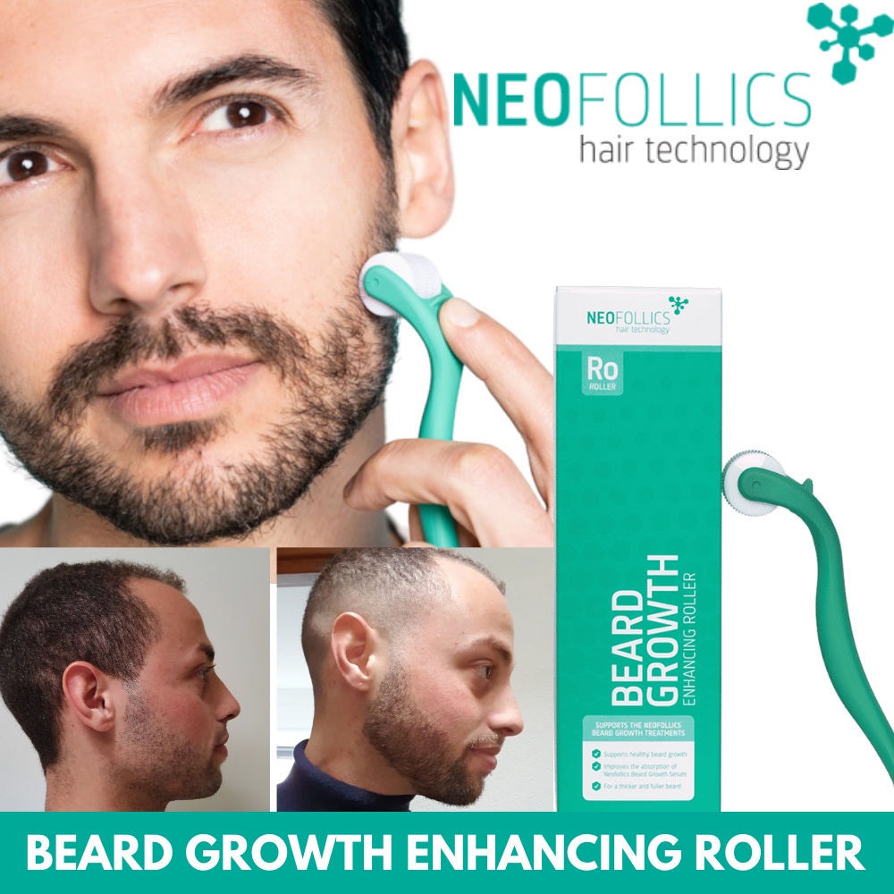 Neofollics Beard Growth Stimulating Roller, Beard Serum, Beard Growth Supplement | Shopee Singapore