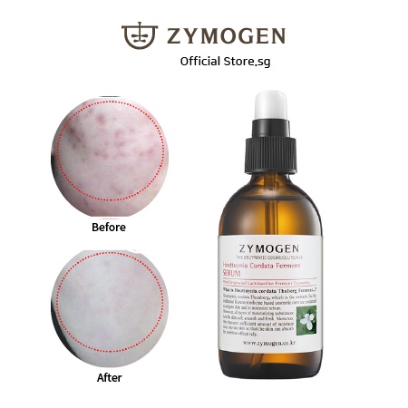 ZYMOGEN Houttuynia Cordata Ferment Serum 105ml for Acne Soothing Serum ...