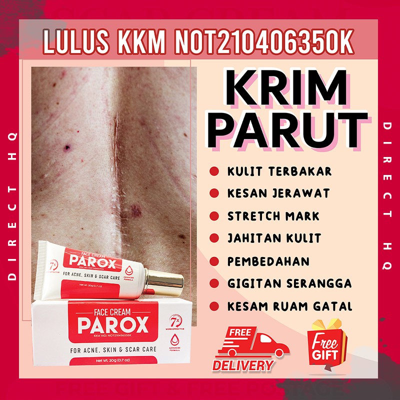Ubat Parut Face Cream Parox Krim Jerawat Krim Parut Acne Cream Pimples ...
