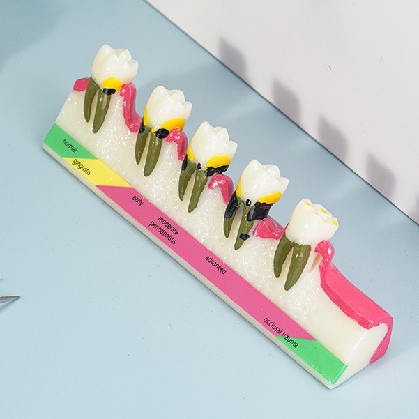 Dental Periodontal Model Tooth Study Teaching Model for School /Lab ...