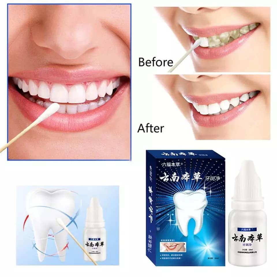 TONG'S Teeth Whitening Quick Effect Yellow Dental Plaque Black Stain ...