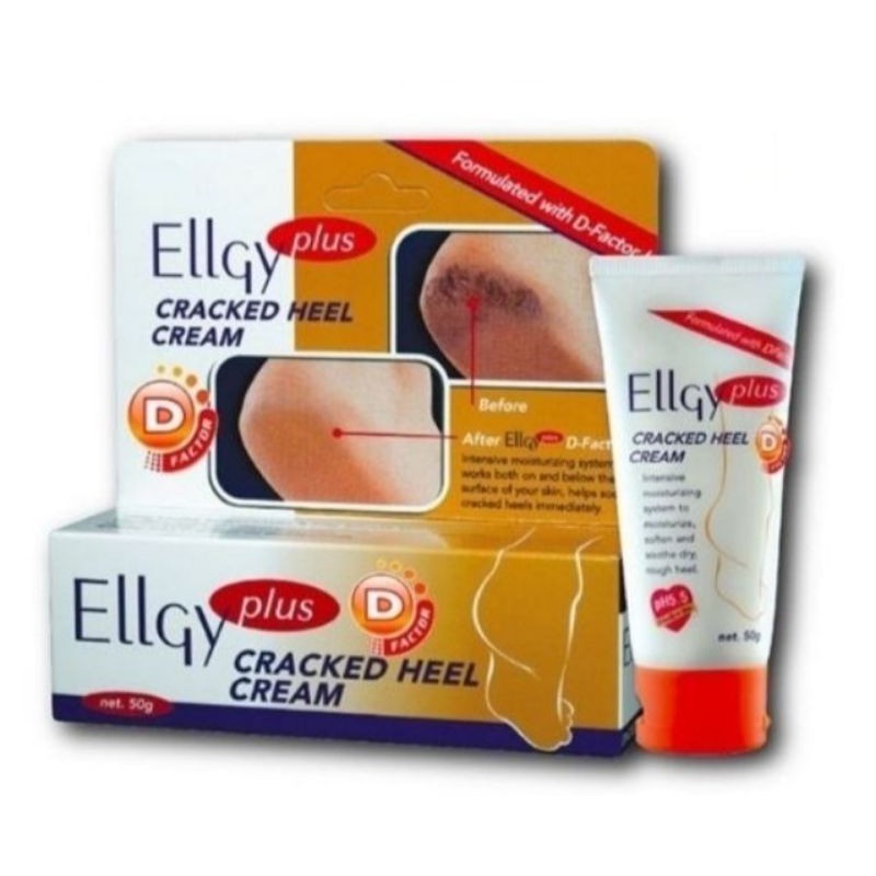 Ellgy Plus D Factor Cracked Heel Cream 50g (Exp: 1/2025) | Shopee Singapore