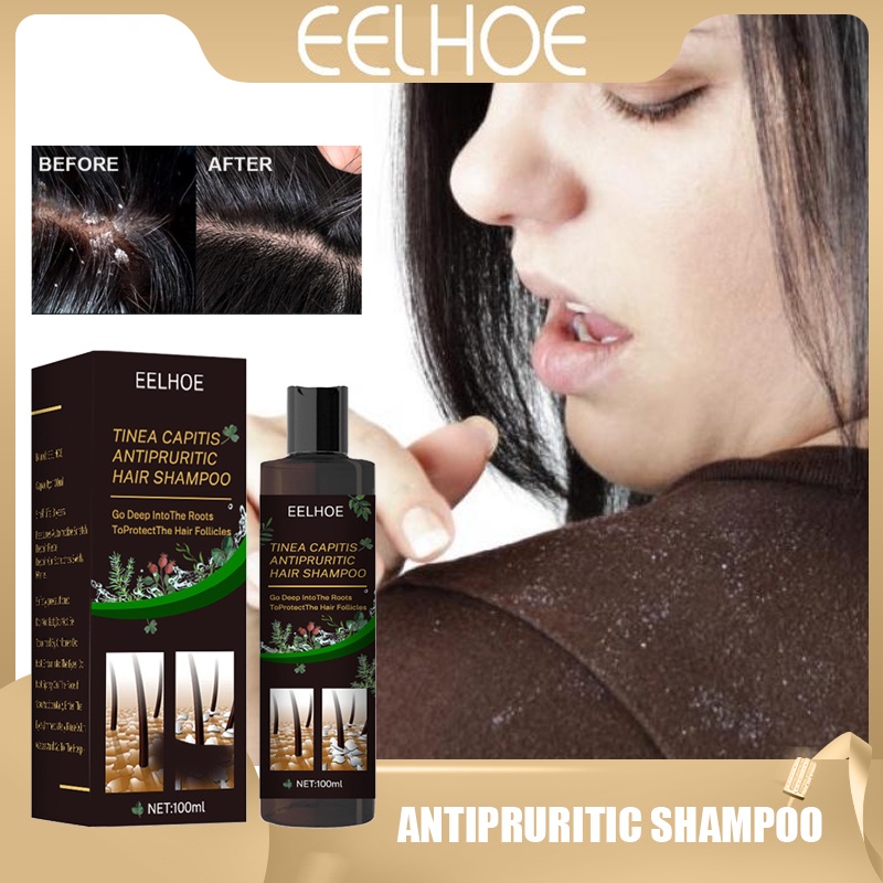 Eelhoe Tinea Capitis Antipruritic Hair Shampoo Tinea scalp anti itching ...