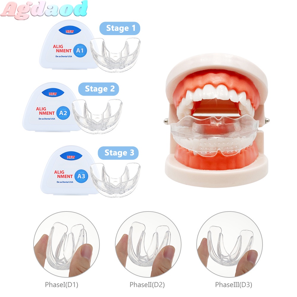 Agdoad 3 Stages teeth alignment care braces teeth straightener brace ...