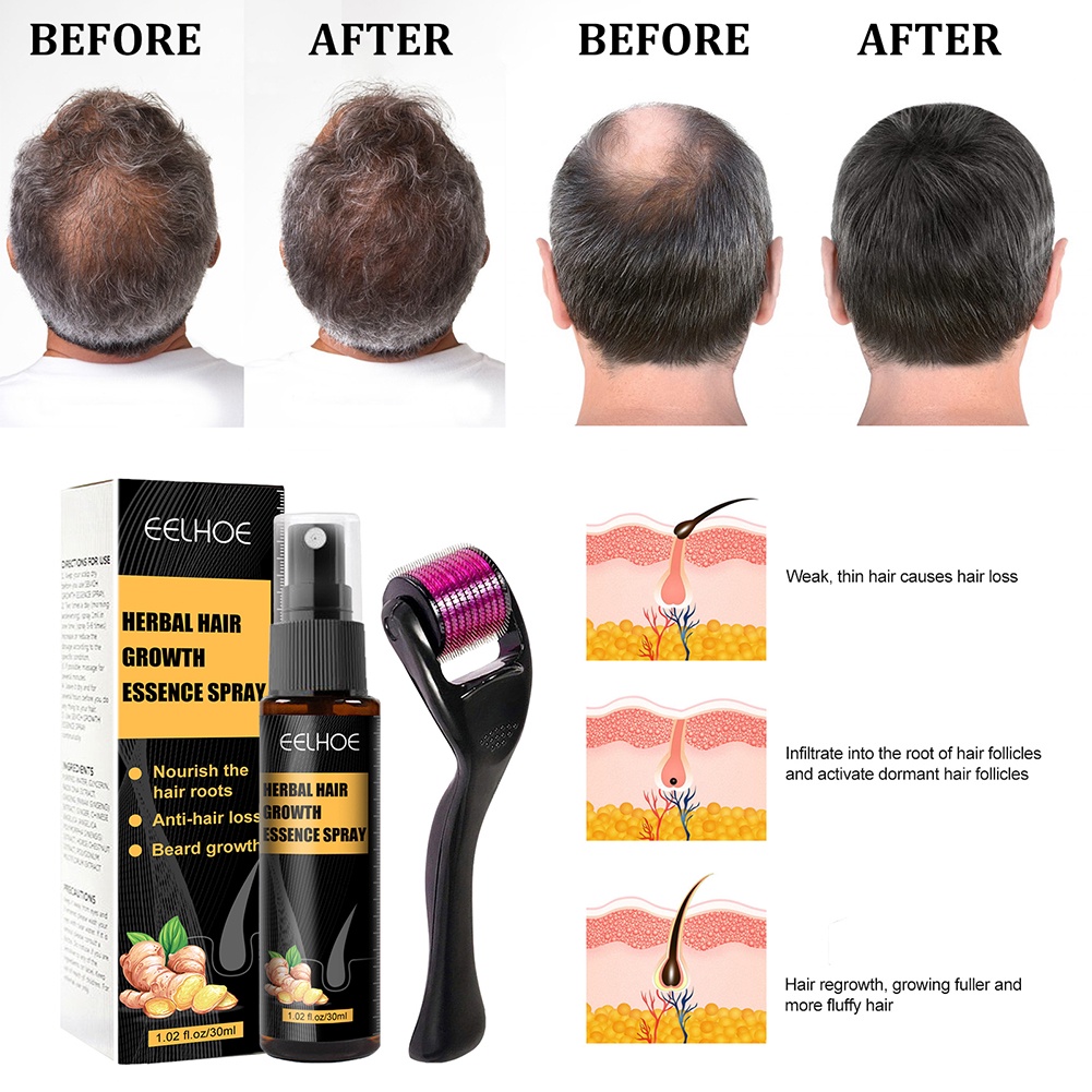 Natural Effective Beard Growth Essential Oil Nourishing Beard Chest ...