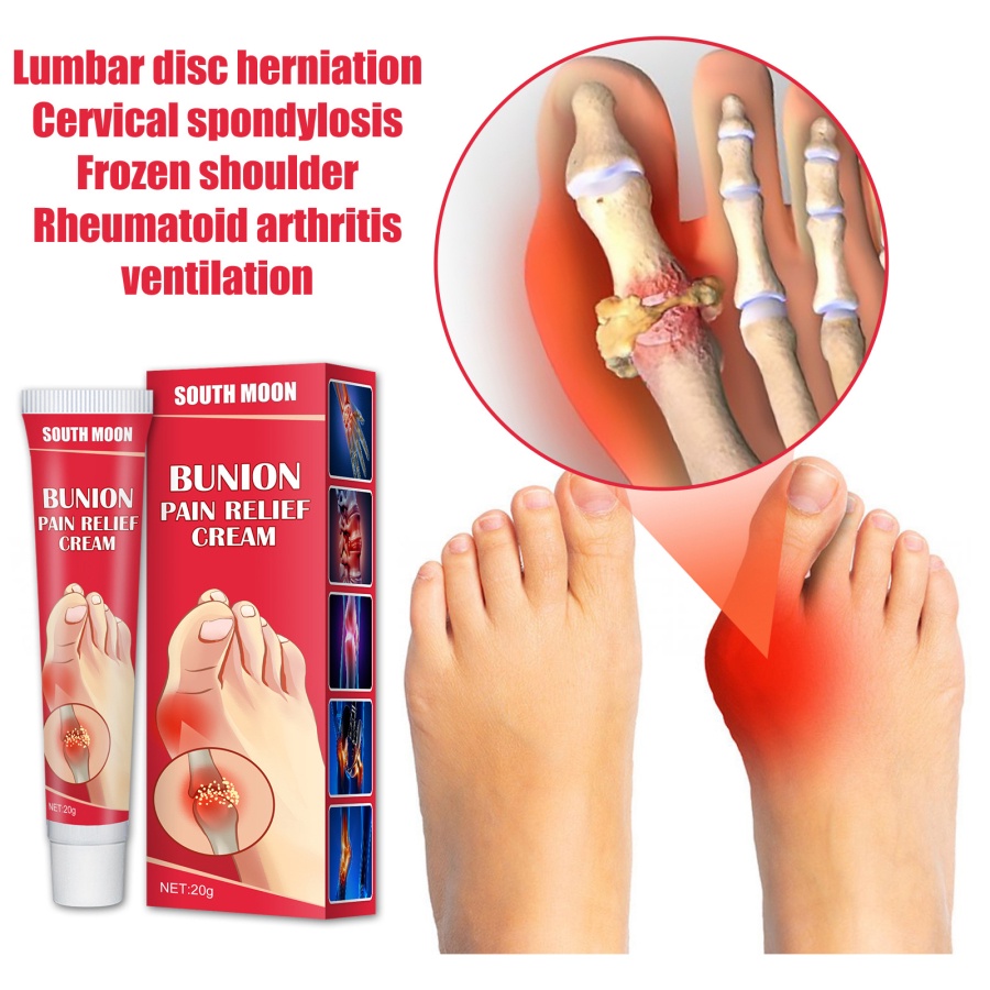 LLKQQ 20g Bunion Gout Pain Relief Ointment Toe Joint Valgus Corrector ...