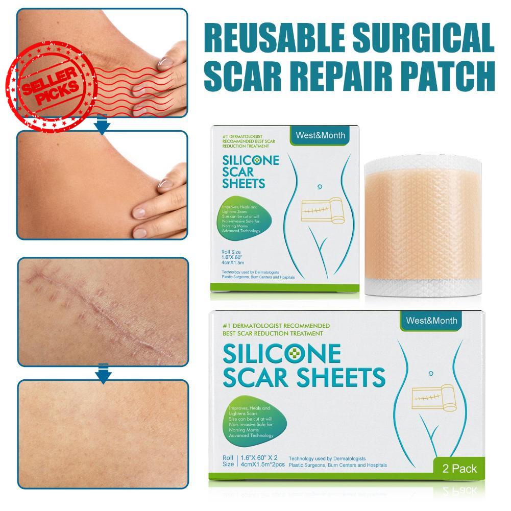 1 Roll Surgery Scar Removal Silicone Gel Sheet Patch Repair Sticker ...