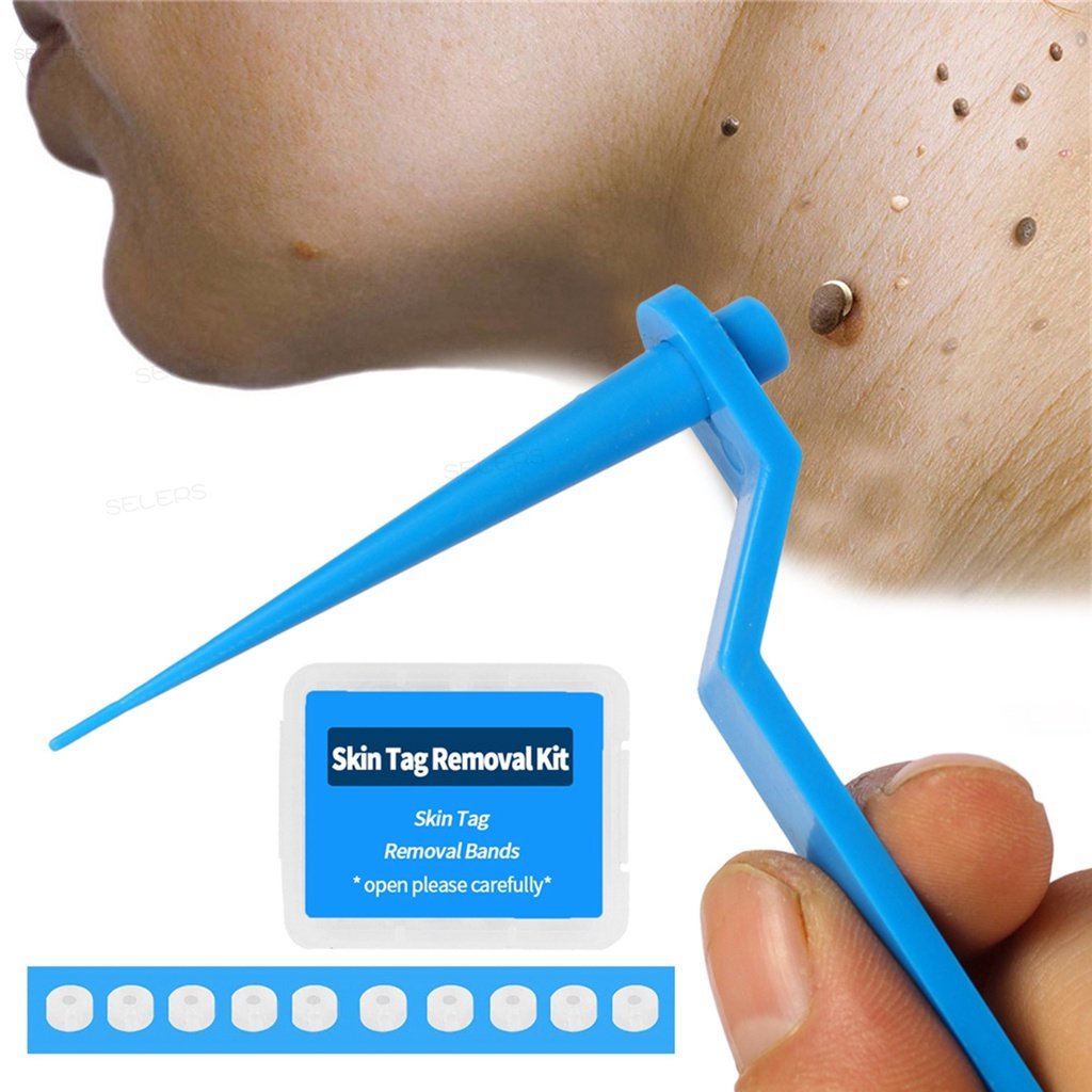 Skin Tag Remover Band Warts Removal Rubber Band Adult Mole Kulugo ...